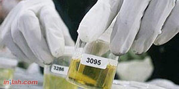 Warna Urin, Cara Unik Deteksi Kesehatan - Lentera24.com