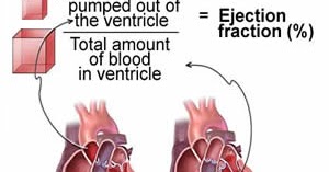 Ejection Fraction ( EF )