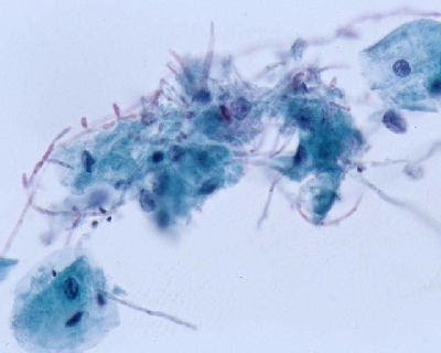 Histología Básica y Sistémica: Citología Cervical II