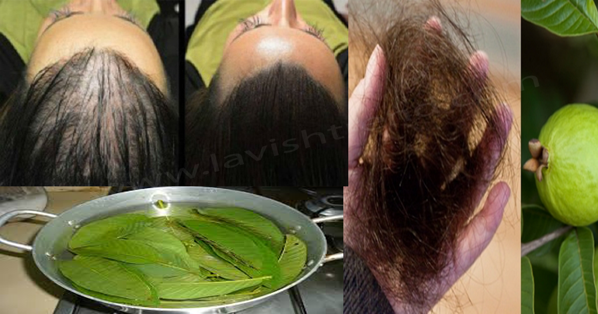 Guava Leaves Can Extremely 100 Stop Your Hair Loss And Make It Grow