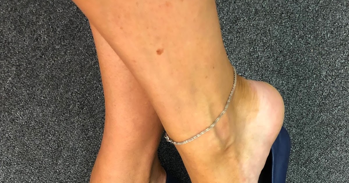 Briddys Feet: Smelly stinky flats everywhere