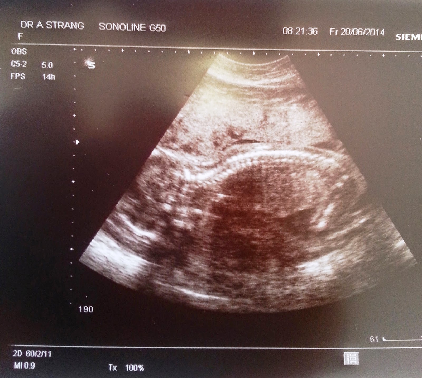 Living Hillcrest: 3 + 1 = 4 (excitement!)