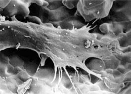 The Skeletal System: What is Artificial Bone?