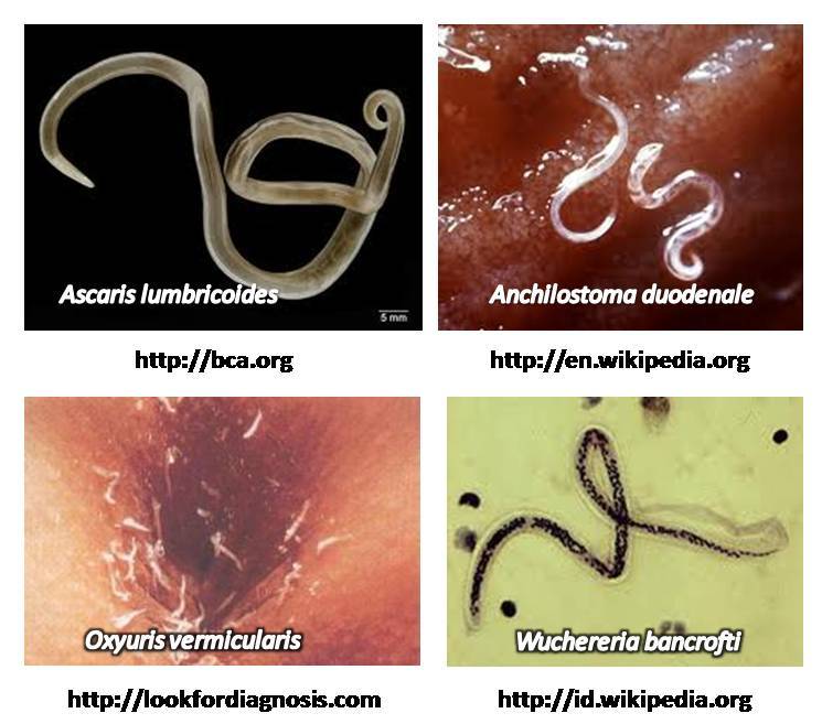 Tanda-Tanda Cacingan Dan Pencegahannya - ragam manfaat