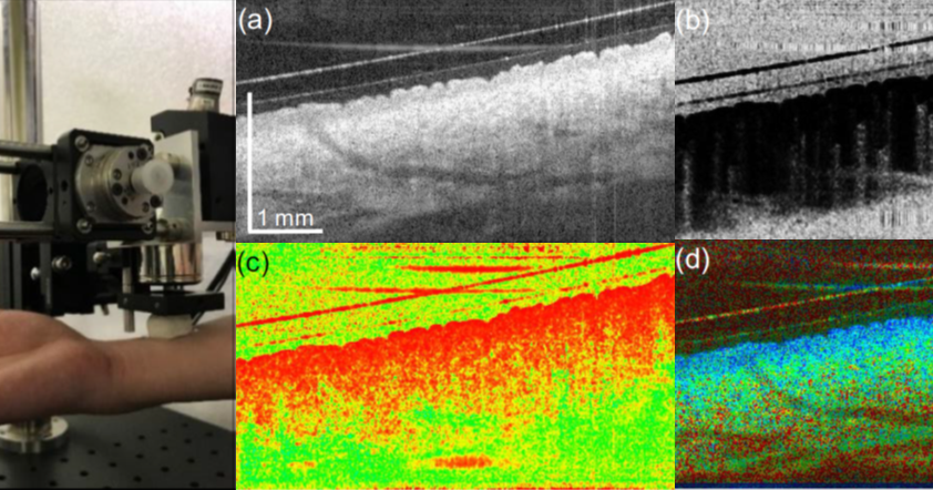 Computational Optics Group Press Room: Publication: Multi-contrast Jones matrix OCT for skin imaging