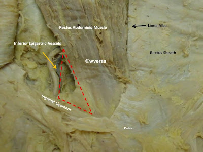 AnatomyWVeras: julio 2012