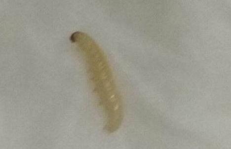 Kaget Temukan "Ulat Putih" di Pakaian Dalam Saat Nyuci! Ternyata ...