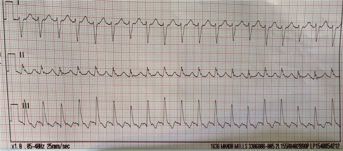 Dr. Smith's ECG Blog: July 2017