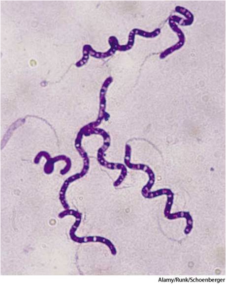 Afrianaa: April 2017
