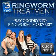 Scalp Ringworm - Tinea Capitis: How to Treat Kerion