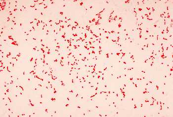 Blog FUAD - Informasi Dikongsi Bersama: Most Dangerous Bacteria