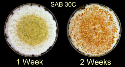 Fun With Microbiology (What's Buggin' You?): Arthrographis species