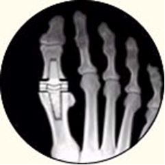 Central Florida Foot and Ankle Center - For all the women out there ...