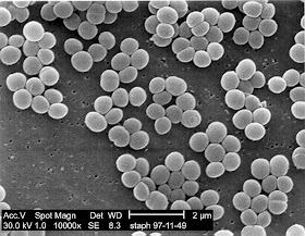 Microscope World Blog: Staphylococcus Under the Microscope