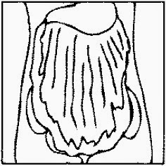 TechnoKiné: Grand omentum (grand épiploon)