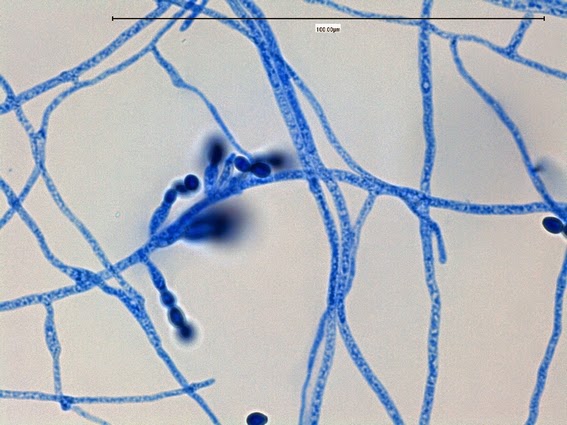 Fun With Microbiology (What's Buggin' You?): Scopulariopsis brumptii
