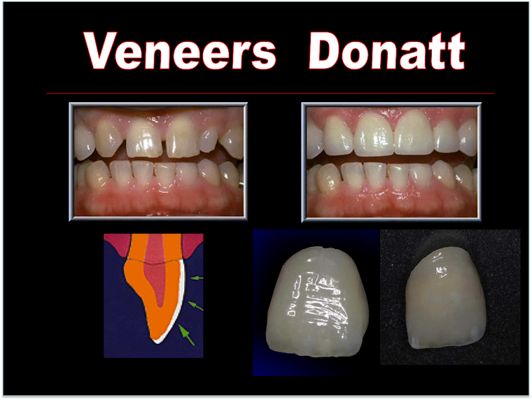 DONATT DENTAL smiles designer