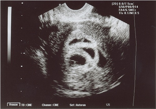 Four by Two: My mother's gift ... to us