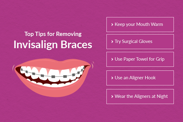Top Ten Tips for Removing Invisalign Braces ~ Invisalign Tips