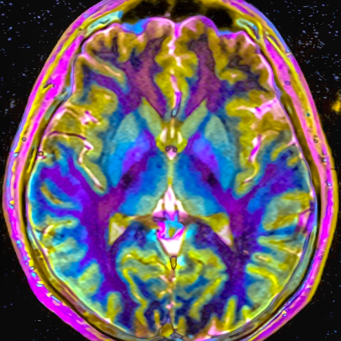 GUEST ESSAY: Further Response to the Psychedelic Neuroimaging ...