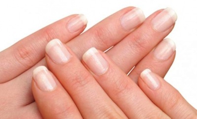 SABES QUE TIPO DE UÑAS TIENES? SABES POR QUE DEBES DE TENERLO MUY CLARO ...