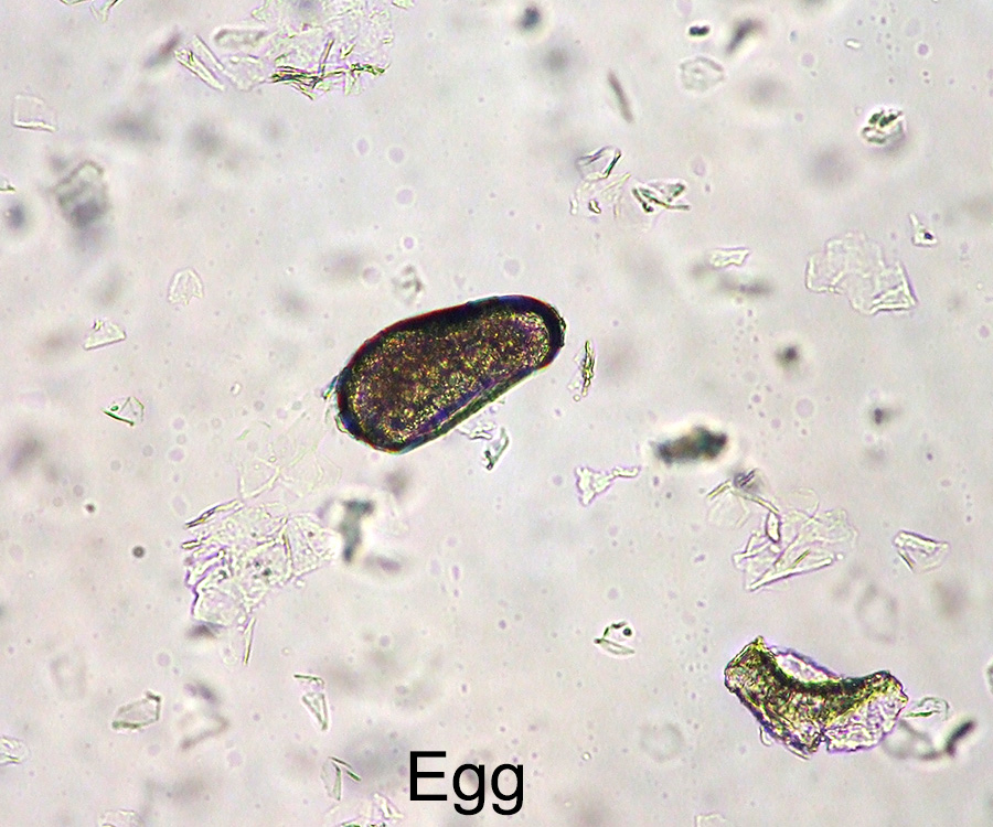 Scabies Eggs Under Microscope