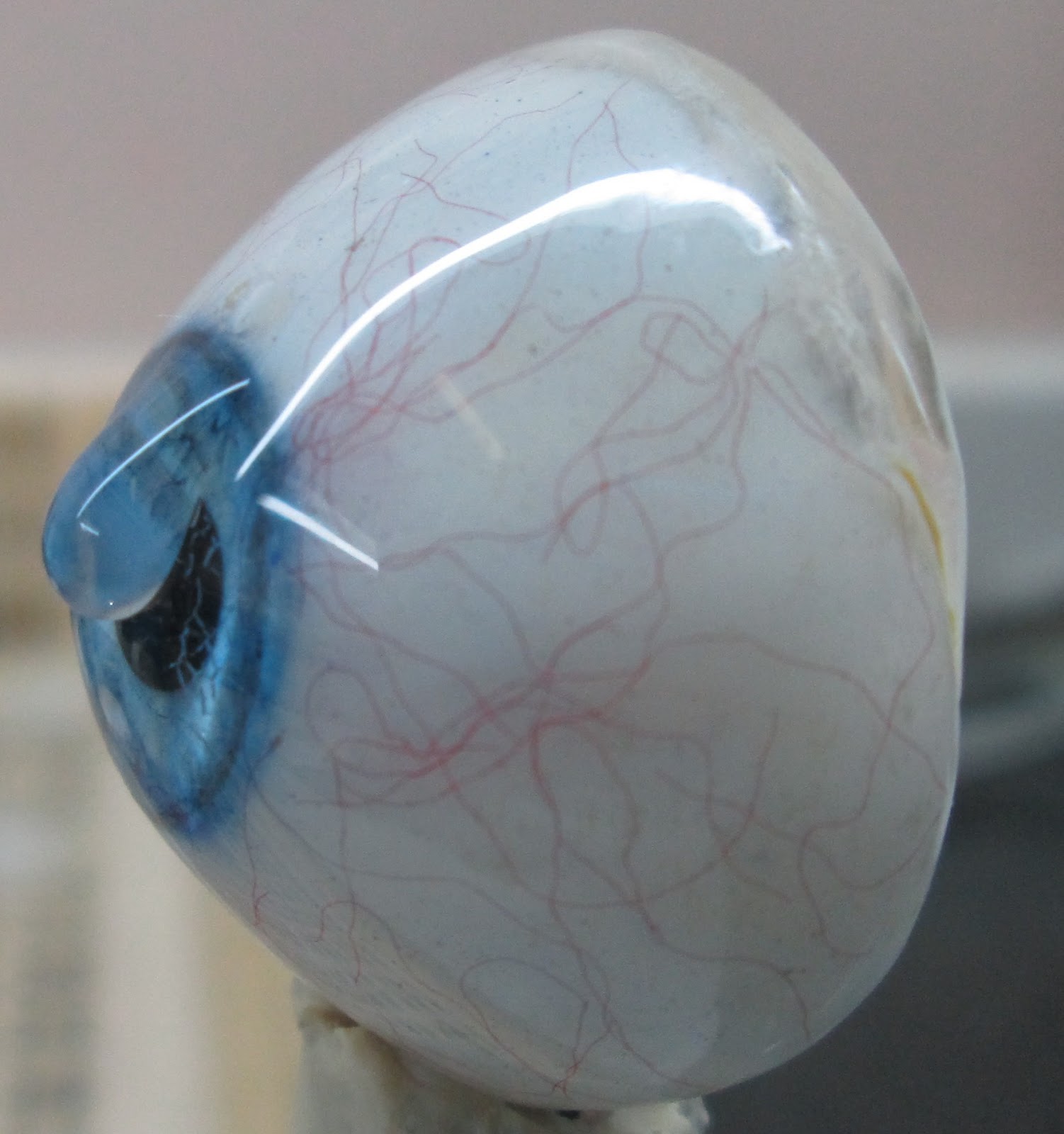 Self-Lubricating Ocular Prosthesis- Kolkata, West Bengal: Self ...