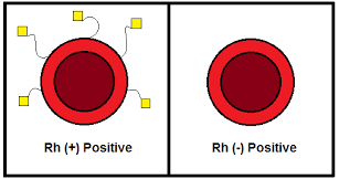 What are the Secrets about Blood Group and Rh Factor - improving knowledge