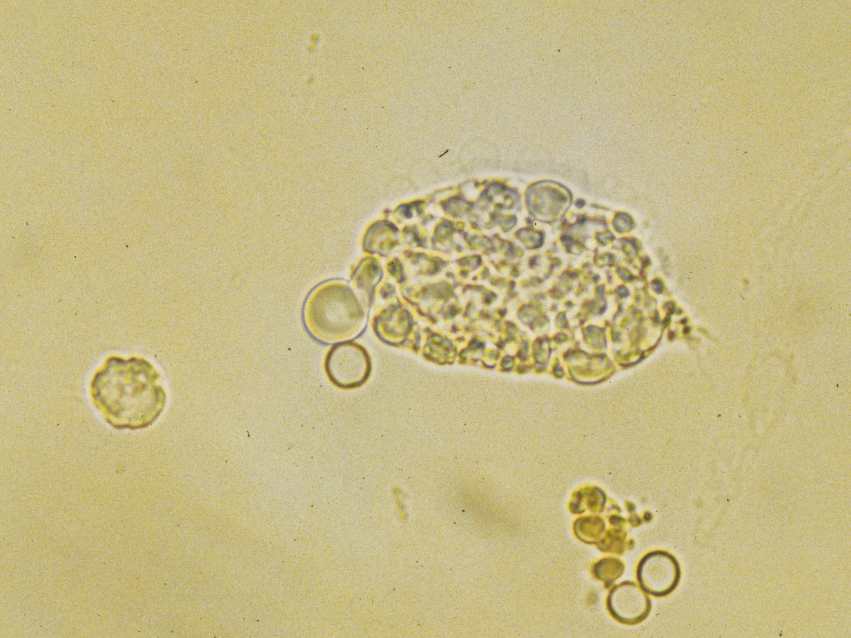 Urine Artifacts ~ Medical Labs Everyday