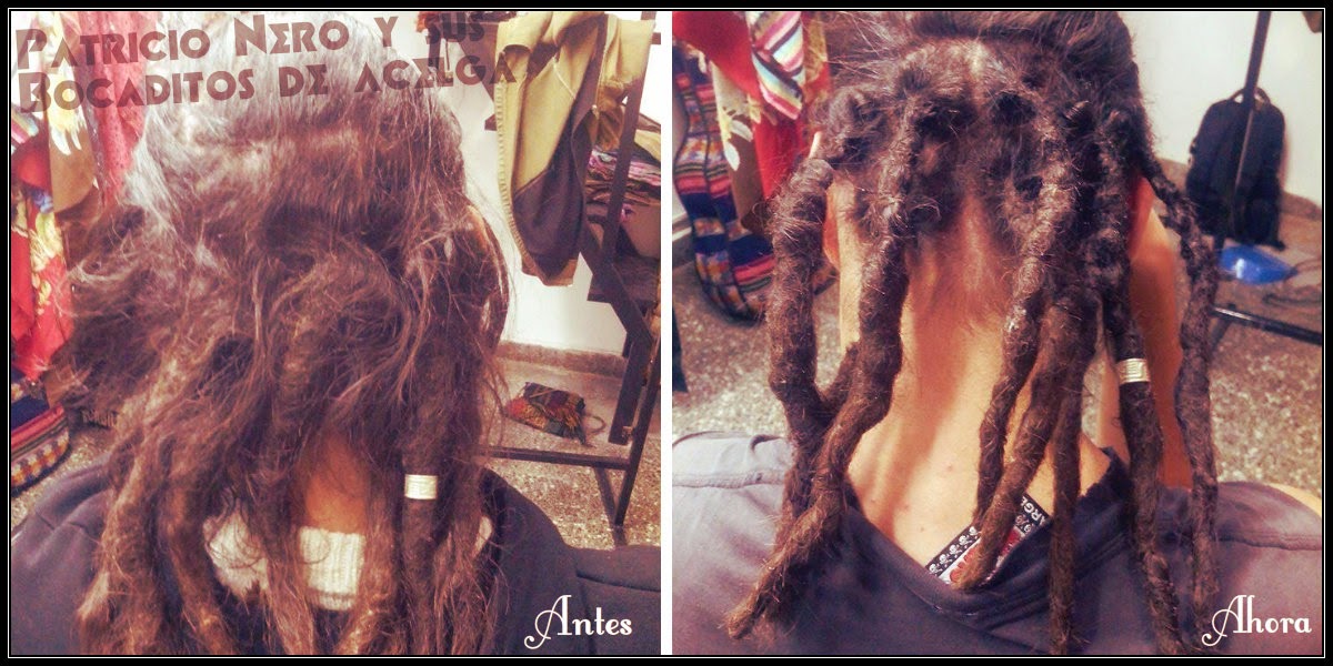 Dreadlocks