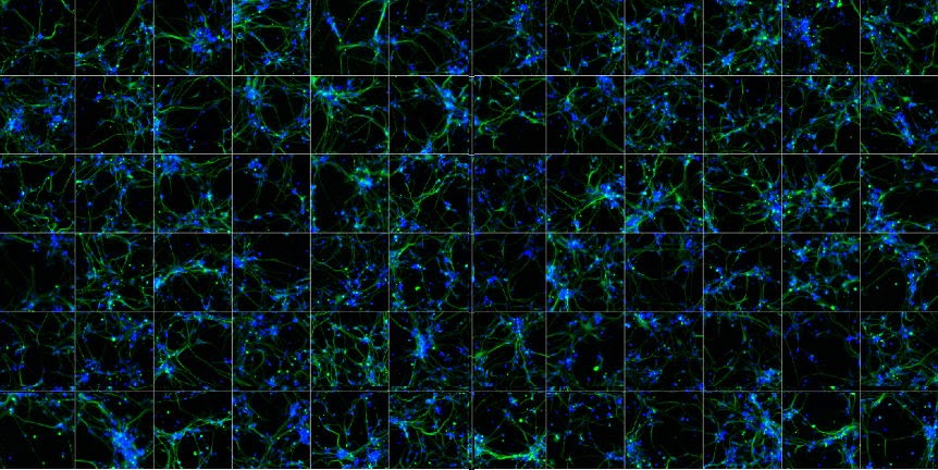 Neuromics: Neurite Outgrowth Assays-96 Well Plates