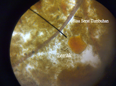 Rizqi Murtafi'ah: Pemeriksaan Feses Lengkap
