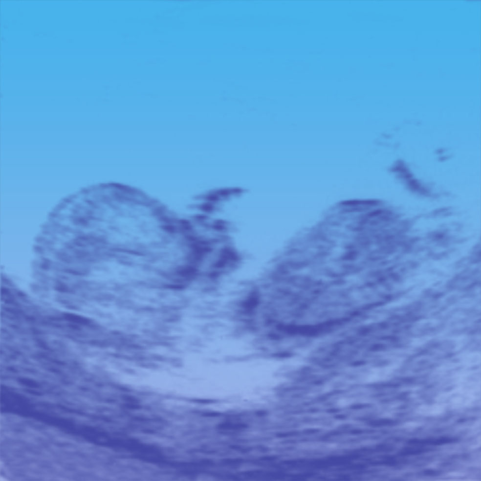 Baby Scan Artworks | deckflair