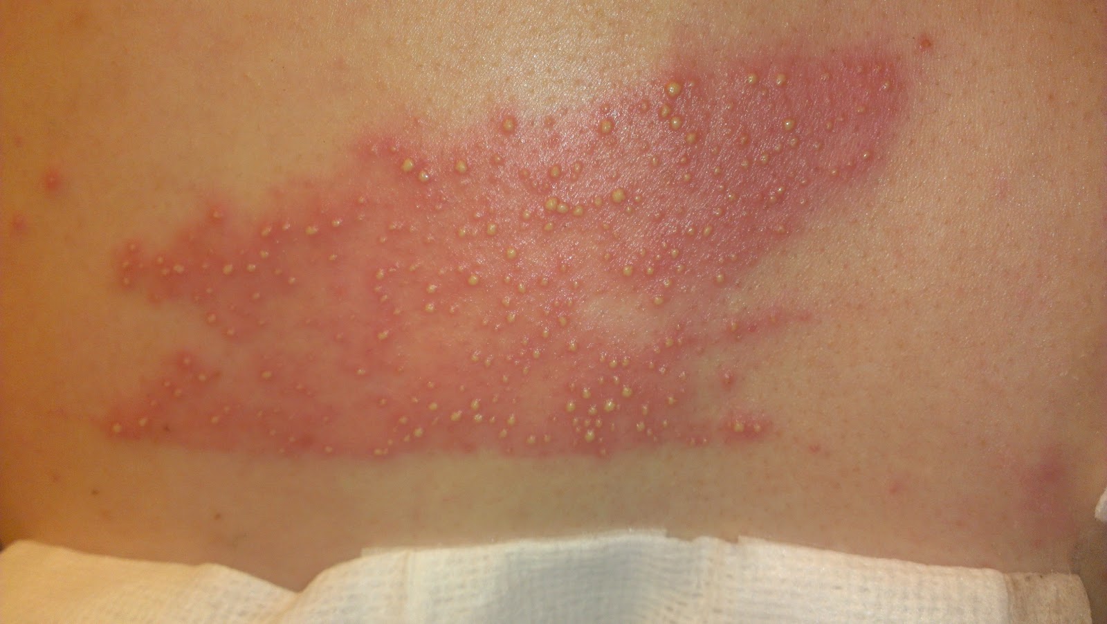 So I have Thyroid Cancer... The Story