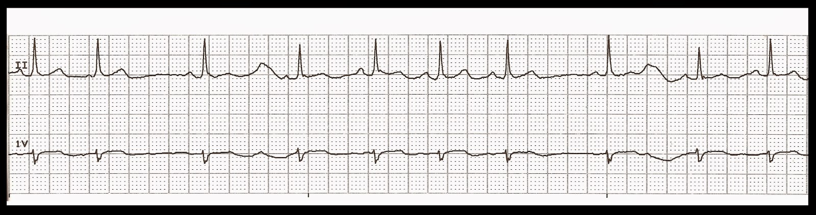 Practice EKG Strips 408