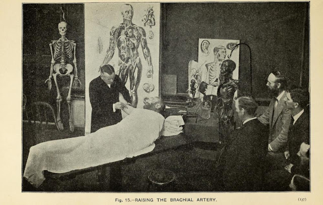 MikeLiveira's Space: Images from The Champion Text Book on Embalming (1897)