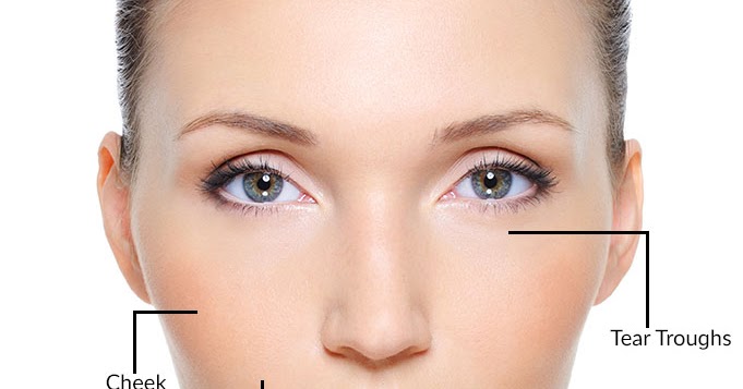 Selston Cosmetic Clinic: Facial Fillers with High & Low G Prime ...