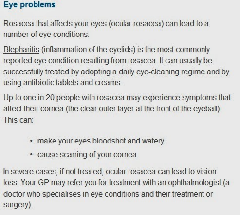 Tights and Ladders: Complications of Rosacea - Rosacea in eyes