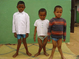 Rachitis : Symptome Ursachen und Abhilfen