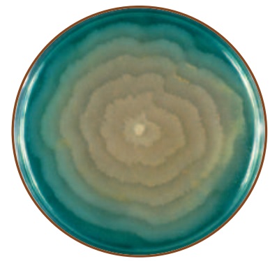 [Microbiology] Atlas of Growth Patterns on Agar | Free Medical Atlas