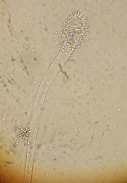 ATLAS MICOLOGIA: ASPERGILLUS CLAVATUS