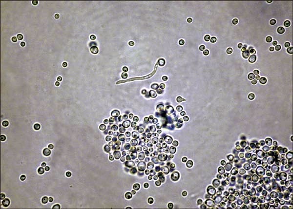 Macroscopic and Microscopic Characteristics of Ocular Fungal Isolates ...