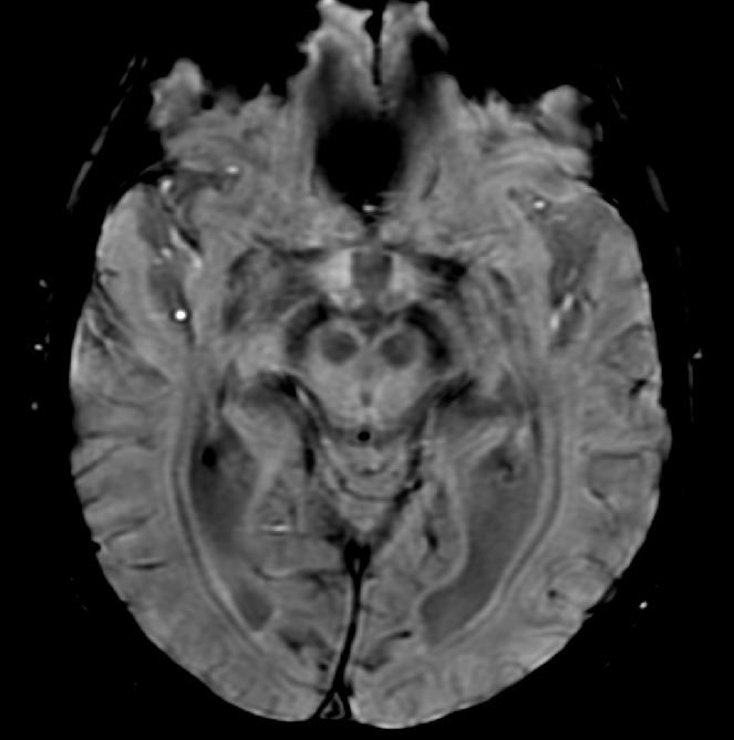 Dr Balaji Anvekar FRCR: MY PARENT INSTITUTE 3T MRI