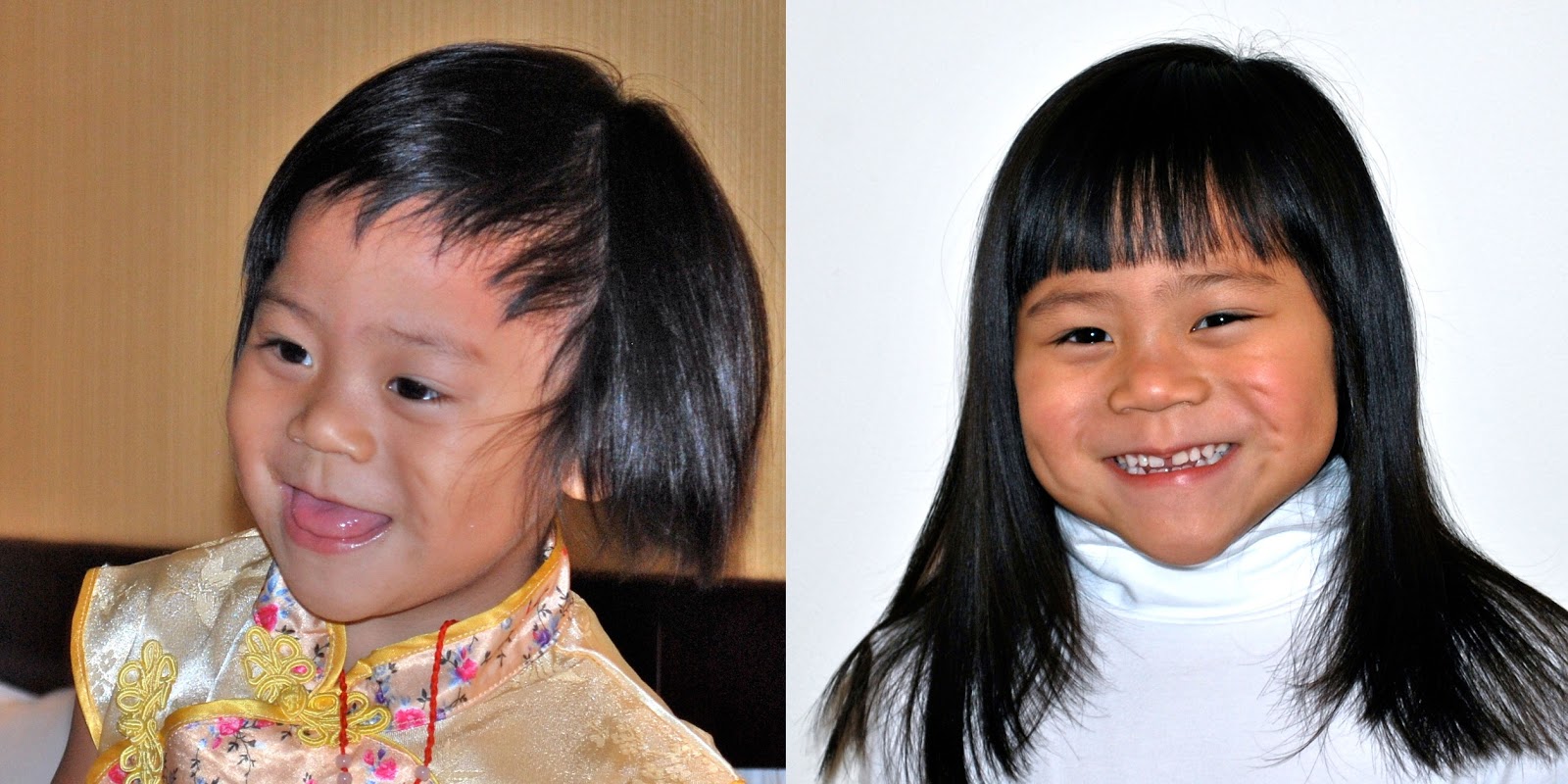 Bring my sons from afar...: BWS - Enlarged Tongue (macroglossia)