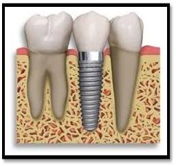 Blog Rasmi Bahagian Kesihatan Pergigian Negeri Perlis: Perkhidmatan ...