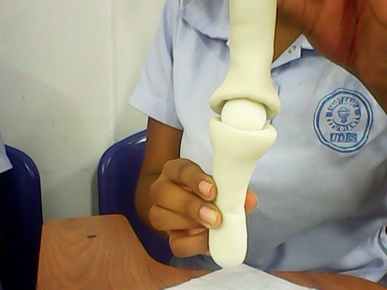 biomecanica: Articulacion Condilea