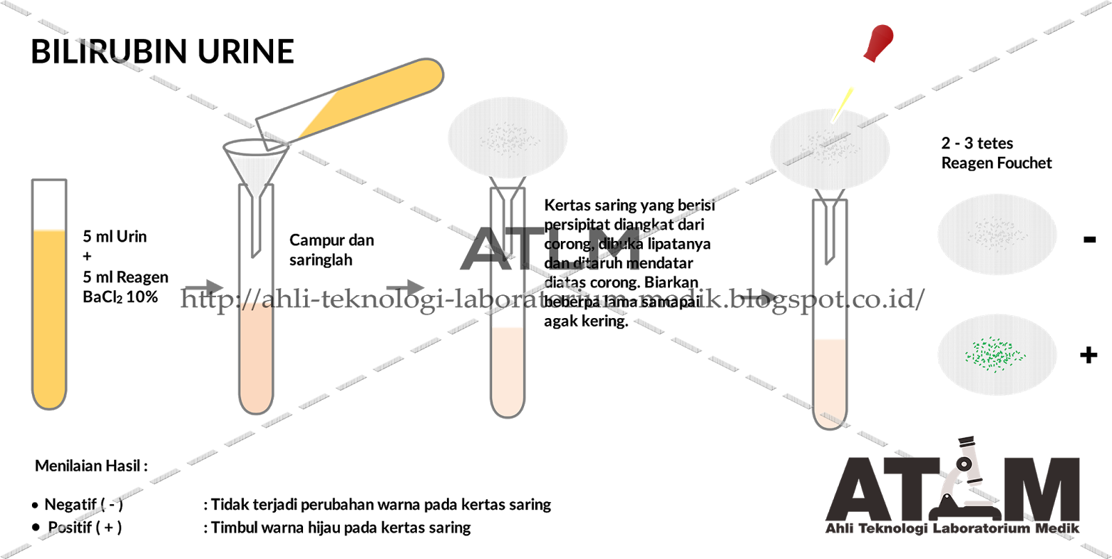 Pemeriksaan Billirubin Urin Percobaan Harrison — ATLM
