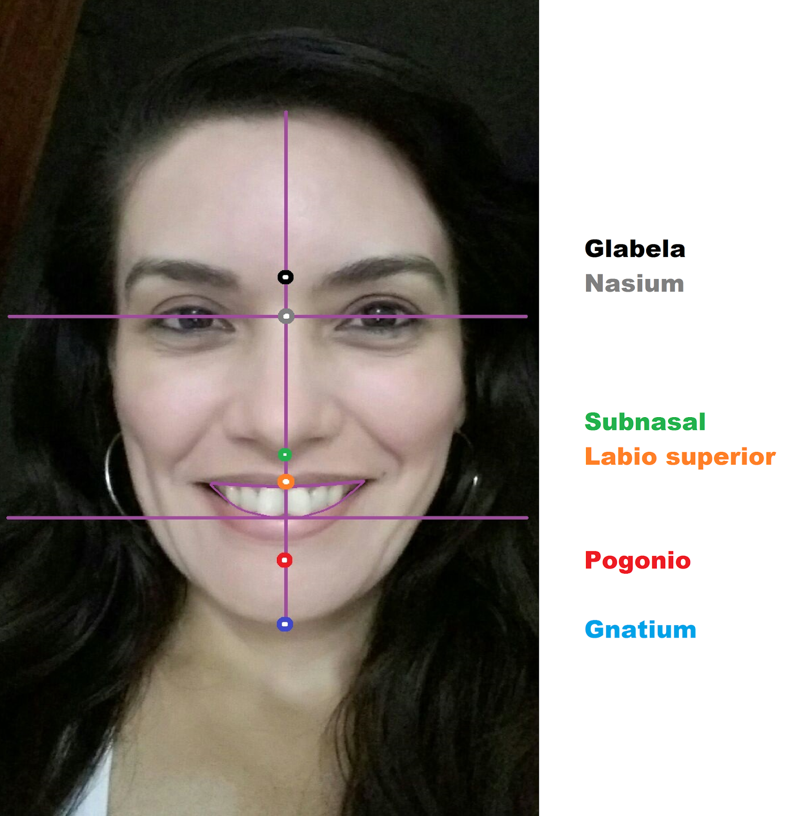 Análisis de Sonrisa : abril 2015