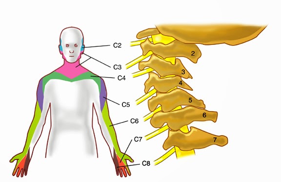 Top 5 Fridays! 5 Treatments That Help With Cervical "Radiculopathies ...