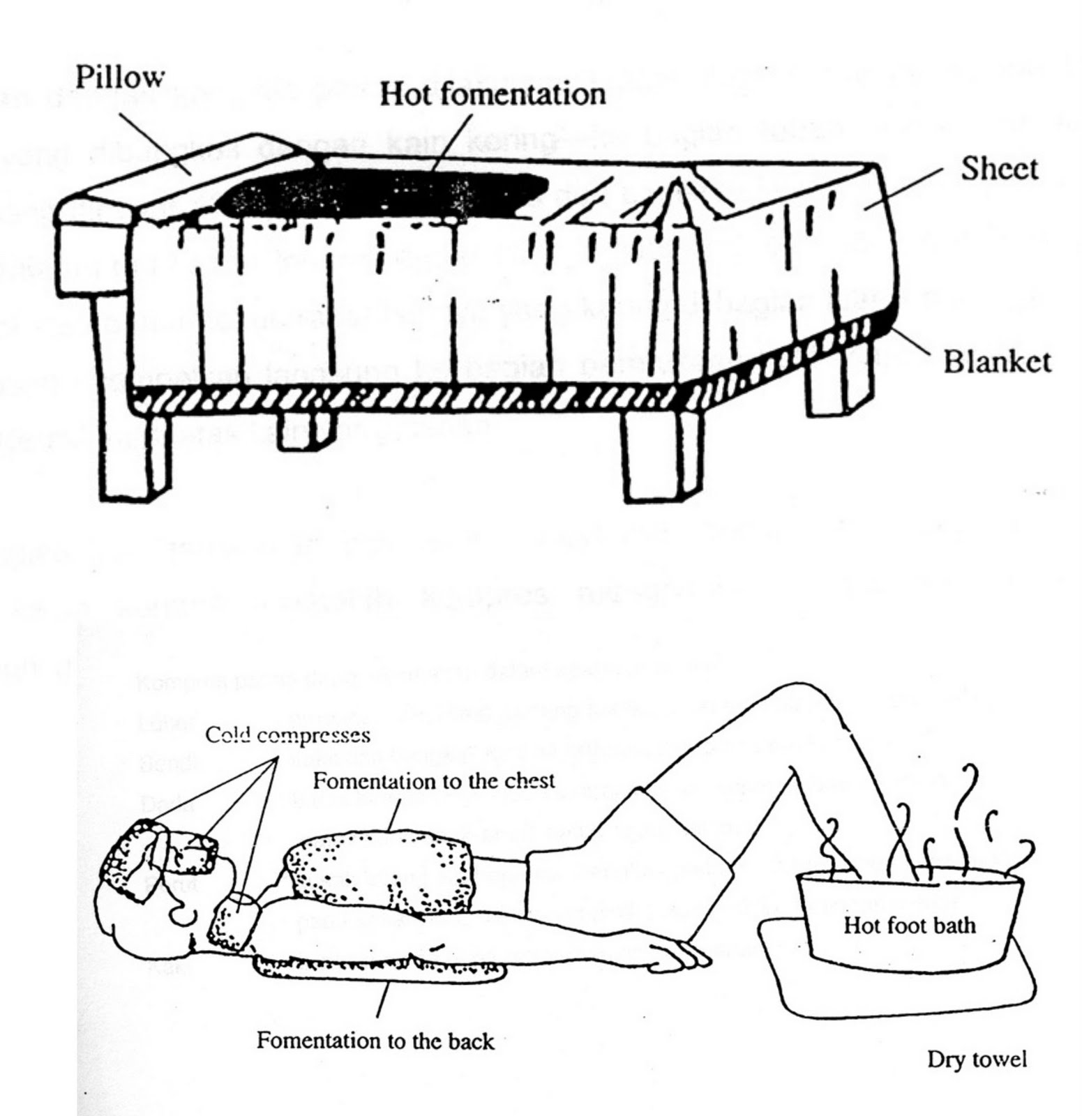 Insan Budiman|*_*|: KOMPRES AIR PANAS DAN DINGIN (FOMENTATION)